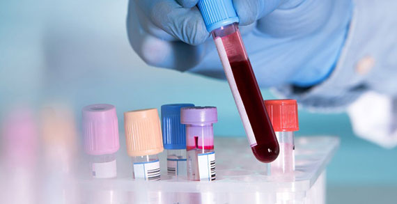 Phlebotomy Proffessionals – Mobile Blood Drawing